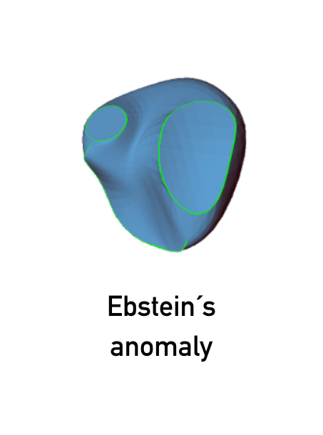 Ventripoint