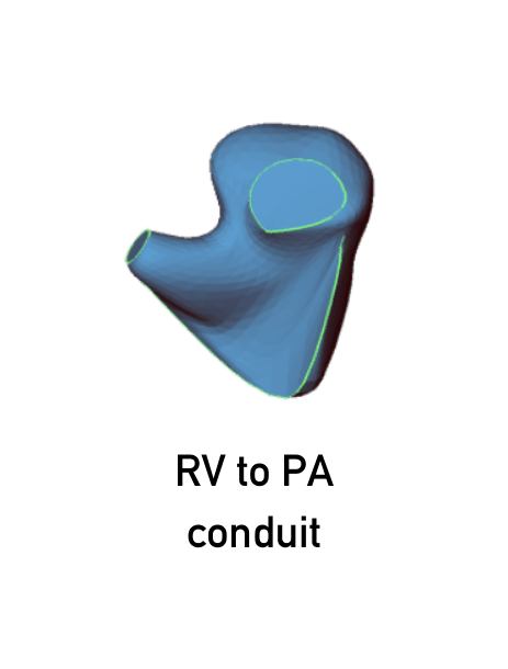 Ventripoint